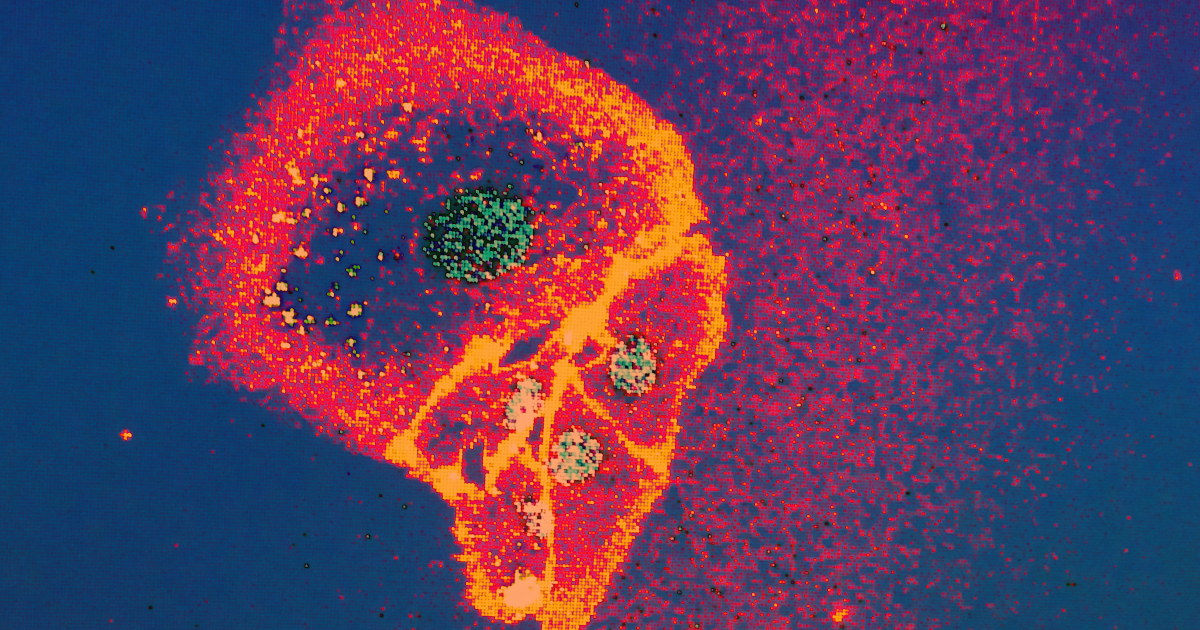 Scientists Used CRISPR To Turn A Cell Into A Biological Computer